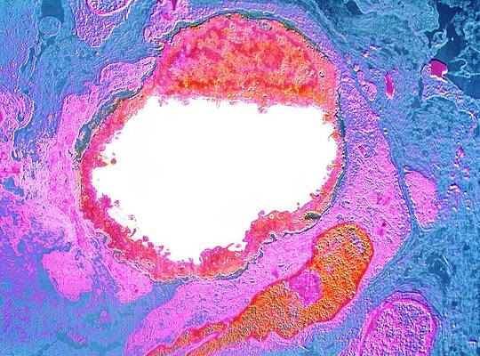 Capillary Art for Sale by Science Photo Library