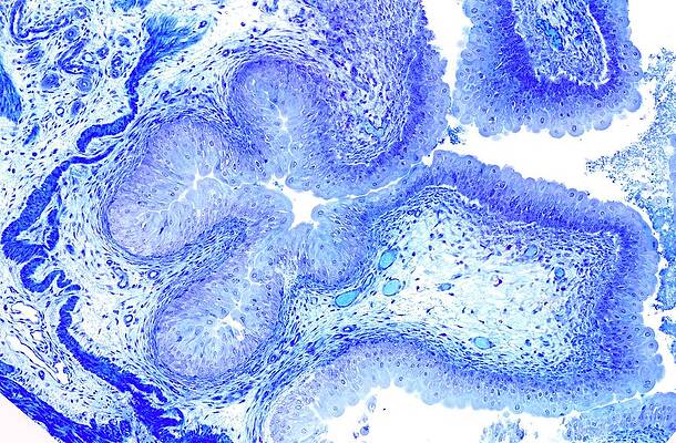 Bladder Wall Art for Sale by Science Photo Library