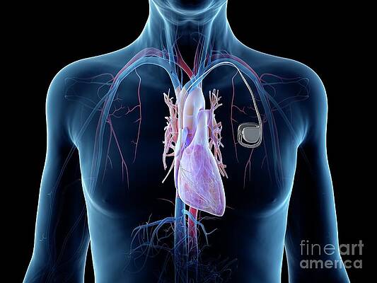 Pacemakers Art - Fine Art America