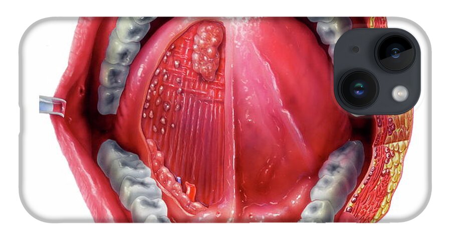 Anatomy Of Underside Of Tongue