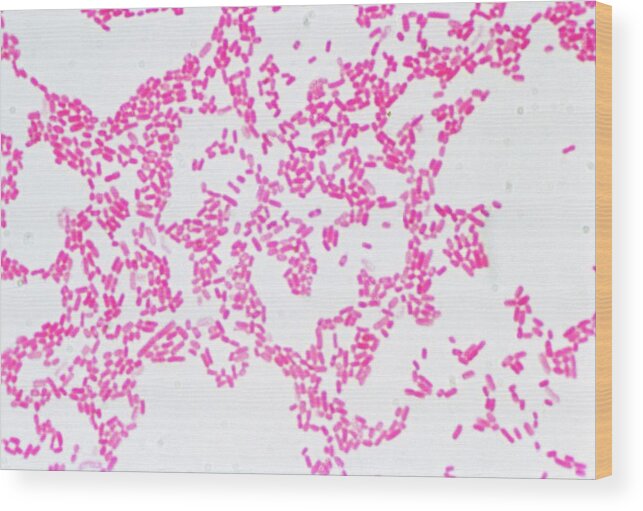 Ecoli Escherichia Coli Bacteria Negative Stain Negative Staining An