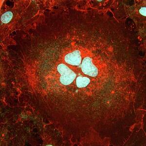 Fibroblast Stem Cells Photograph by Andy Crump/science Photo Library ...