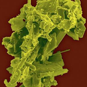 Volcanic Ash Microscope